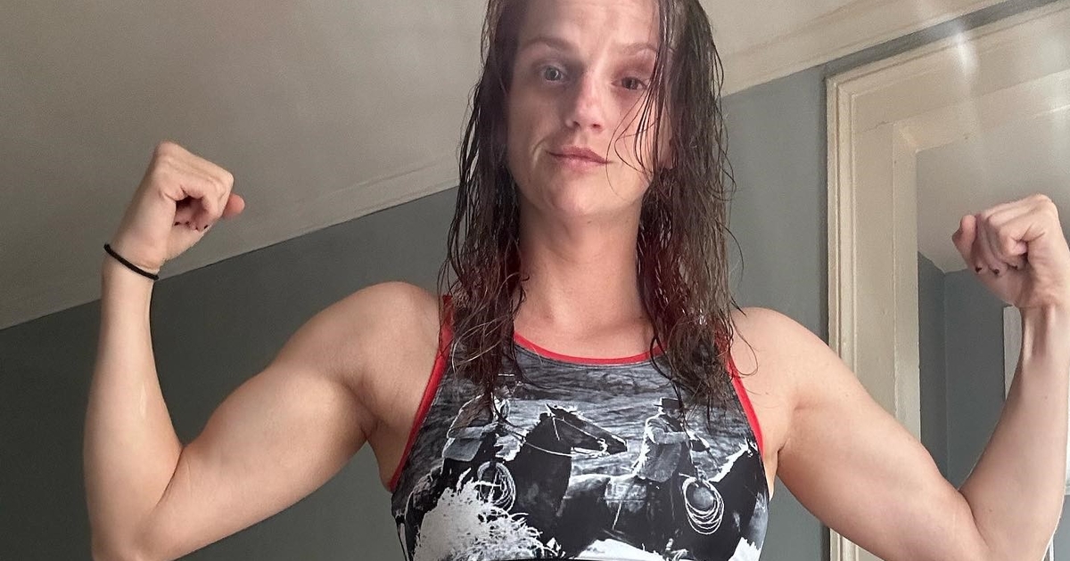 "Лицо Франкенштейна": боксерша показала жуткие травмы после поединка ...